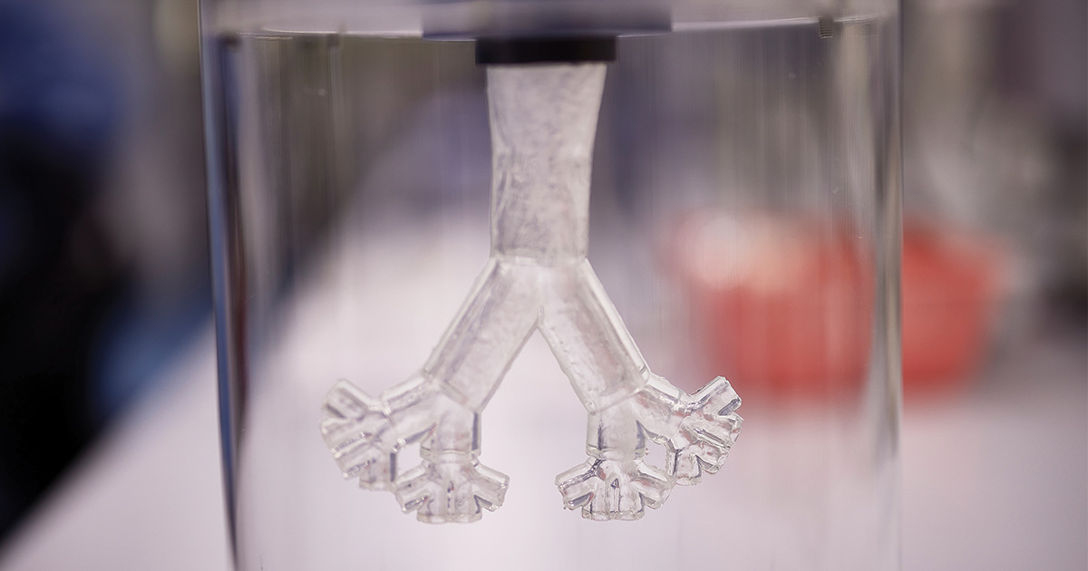 Helping the planet breathe | Woolcock Institute of Medical Research